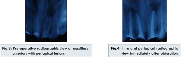 Multidisciplinary Approach in Restoration of Form, Function and ... Multidisciplinary Approach in Restoration of Form, Function and ...