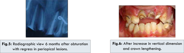Multidisciplinary Approach in Restoration of Form, Function and ... Multidisciplinary Approach in Restoration of Form, Function and ...